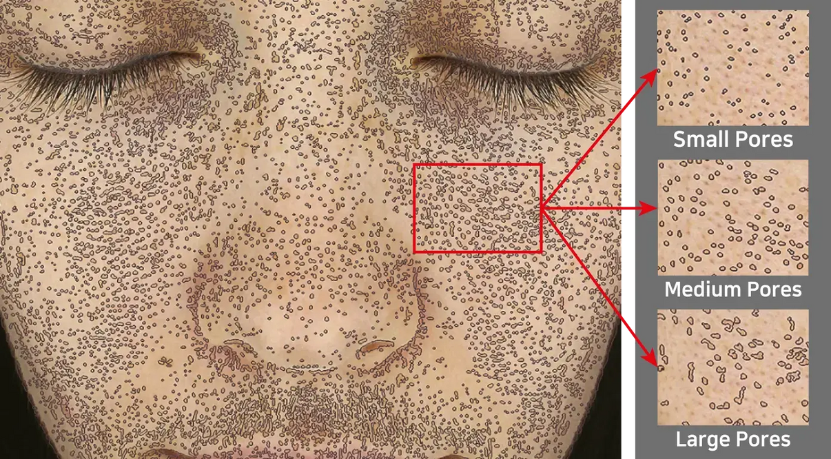 Photographic Skin Analysis Machine | Pure Tone Aesthetics